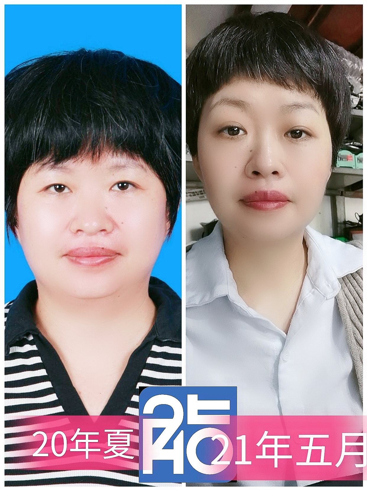 减肥是最便宜的整容-瘦圈-广州瘦吧网络科技有限公司